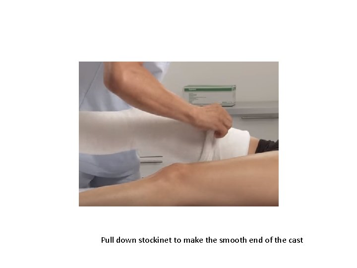 Application of below knee back slab V Kubaitis