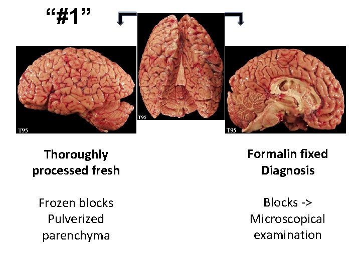NINDS HD Initial brain processing Four options 1