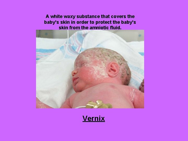 The Newborn Photos and Vocabulary These are used