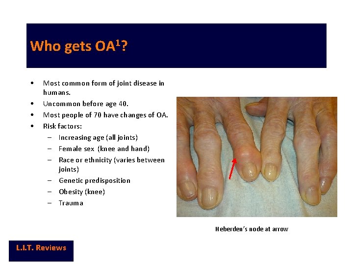 Osteoarthritis Level Basic Version No Version Date Month