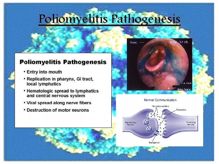 Exponential Models By Sam Schuesler Cynthia Tena POLIO