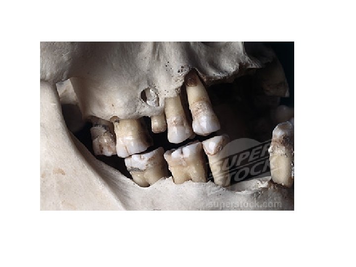 Irritants By Dr Romana Learning Objectives NonMetallic poisons