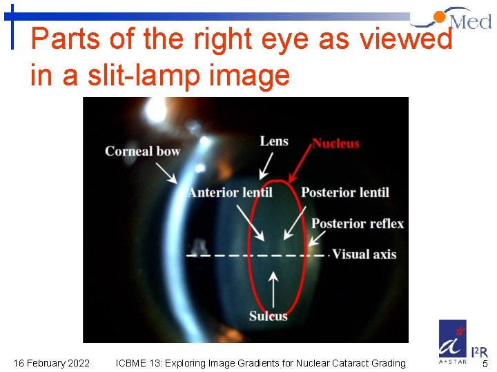 Exploring Image Gradients for Nuclear Cataract Grading by