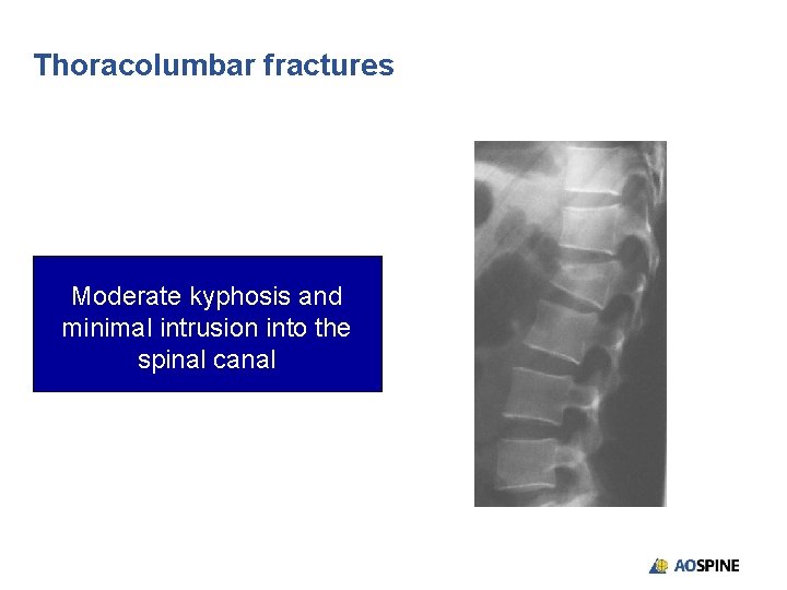 Clinical and radiographic assessment of stability Presenters name