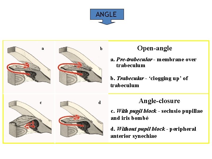 OPHTHALMOLOGY Glaucoma MBCh B 4 Prof P Roux