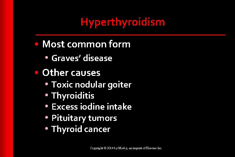 Hyperthyroidism Chapter 50 Copyright 2014 by Mosby an