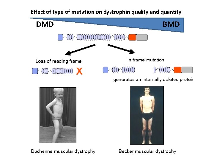 Updates in Research for Becker Muscular Dystrophy Paula