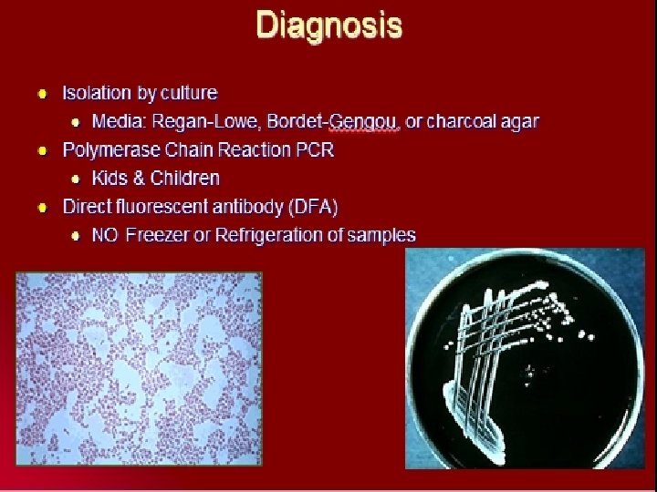 Aerobic Gram negative coccobacillus Alcaligenaceae Family Specific to