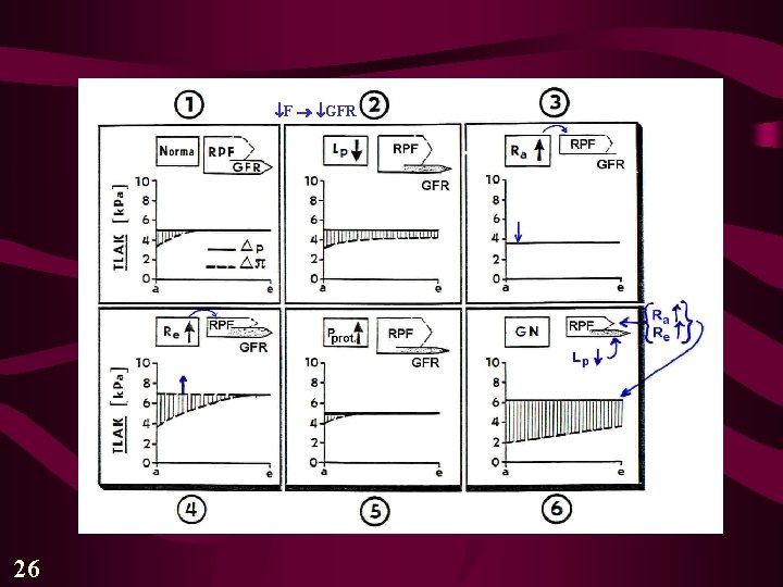 General renal pathophysiology 1 Relationship between plasma solute
