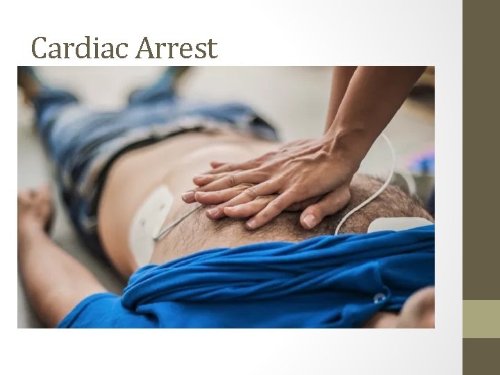 Chest pain and stroke Dr Simon Lynes Heart