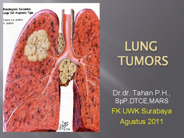 LUNG TUMORS Dr dr Tahan P H Sp