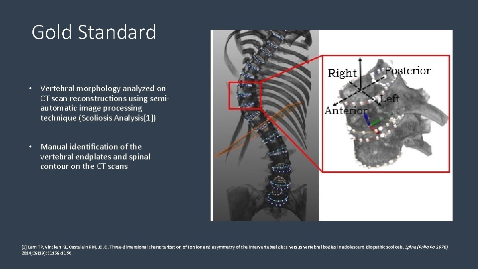 3 D Vertebral Morphological Measurements Using Low Dose