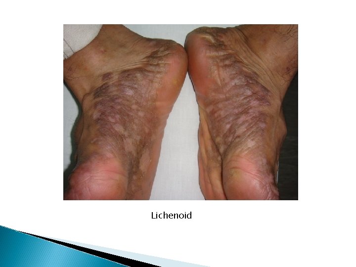 ADVERSE CUTANEOUS DRUG REACTIONS Course 393 Presented by