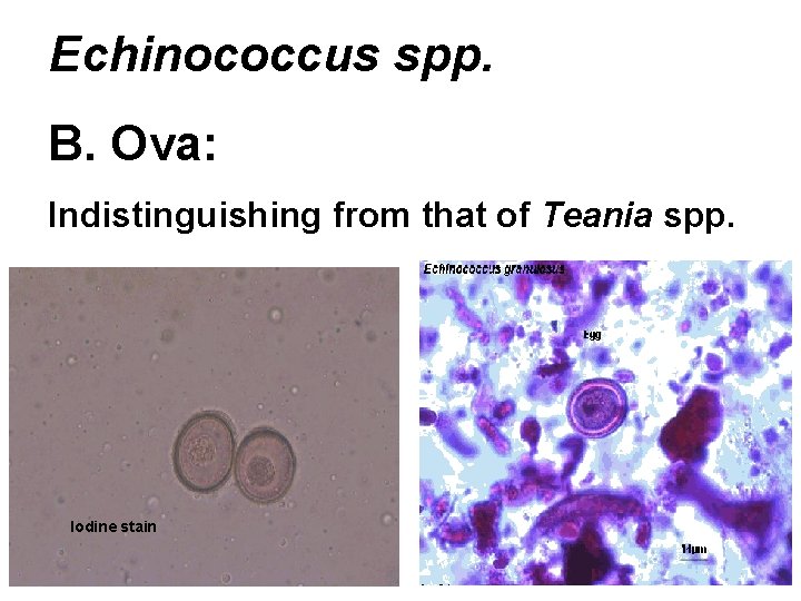 Lab 11 Diphyllobothrium latum Echinococcus granulosus Life cycle