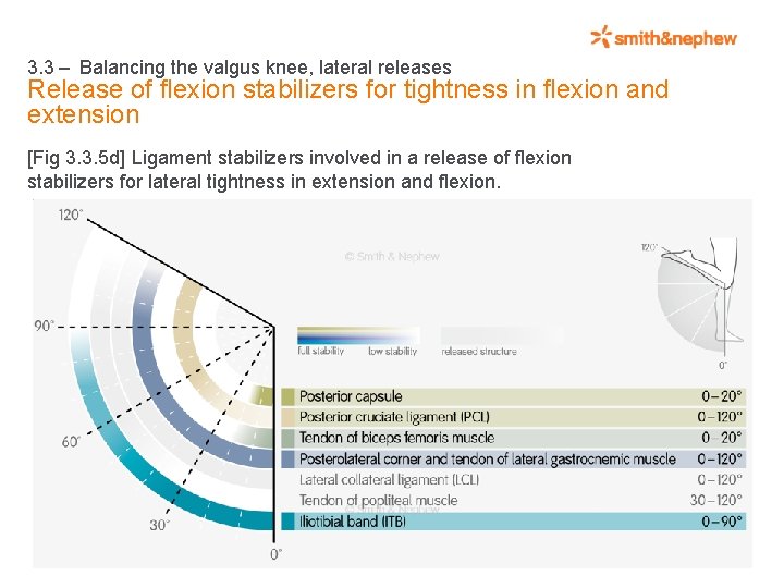 Ligament Balancing in Total Knee Arthroplasty Section 3