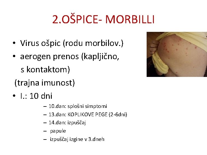 NB Z IZPUAJI ZN 1 NORICE Variccela Zoster