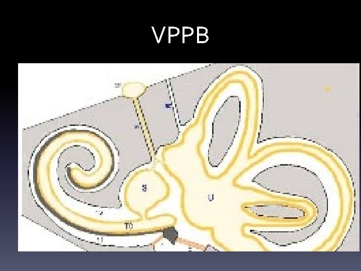 VPPB Dr Nicaise Dr Vovard VPPB le plus