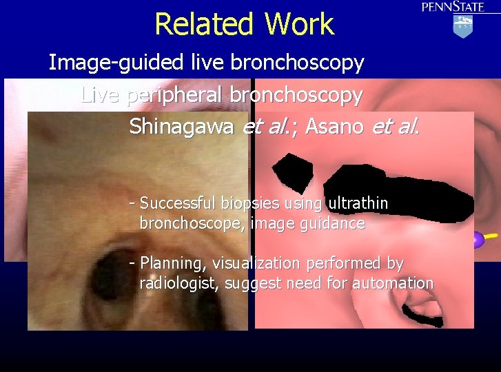 Integrated System for Planning Peripheral Bronchoscopic Procedures Jason