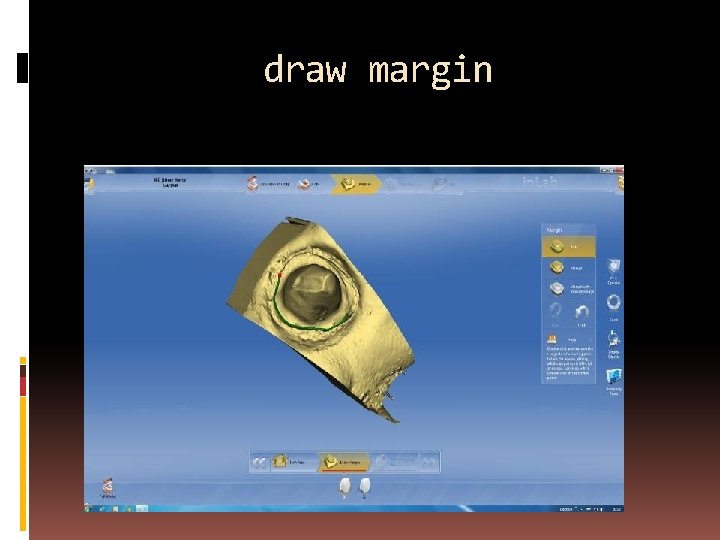 Sirona Cerec Inlab 4 1 The system uses