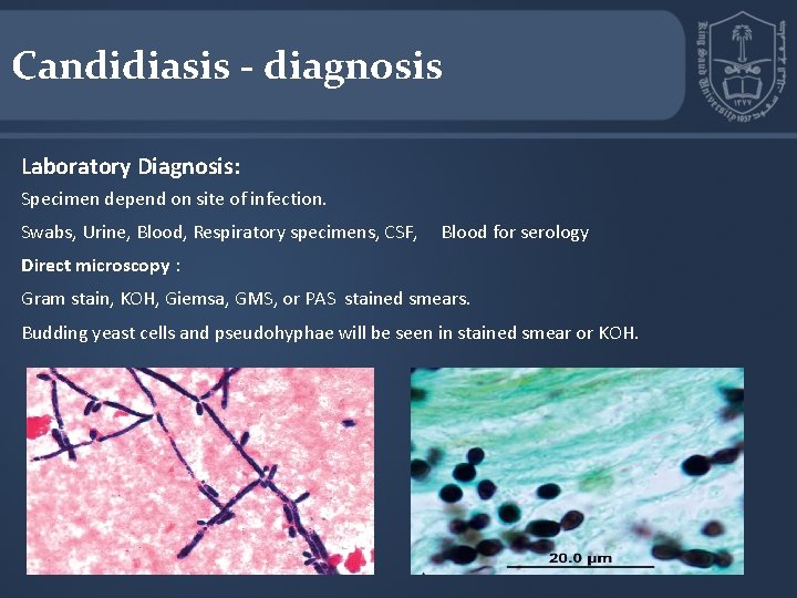 Lecture Title Respiratory Fungal infections II Respiratory Block