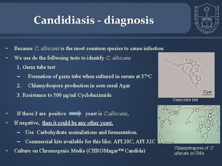 Lecture Title Respiratory Fungal infections II Respiratory Block