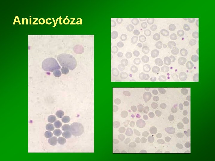 Morfologie erytrocyt Bourkov L Matkov M Hoblov J