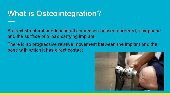 Osteointegration aka Osseointegration What is Osteointegration A direct