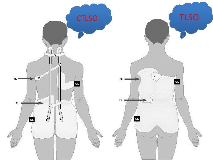 Spinal Deformities Dr Budak Akman T C Yeditepe