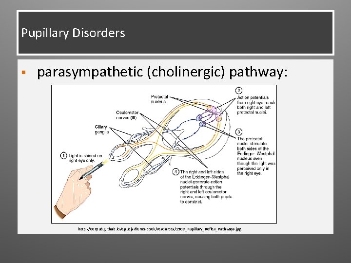 Neuroophthalmology review Daniah Alshowaeir MPH MD Neuroophthalmology ...