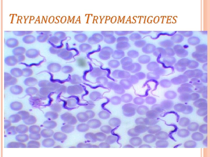 MEDICAL PARASITOLOGY LAB Thick Thin Blood Smear BLOOD