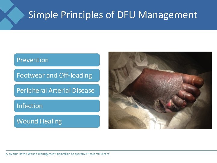 Diabetic Foot Infection and the Vascular Surgeon Dr