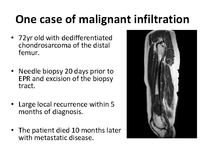 A review of excised biopsy tract histology for