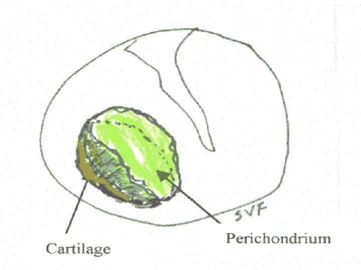 A simple technique to close subtotal perforations of