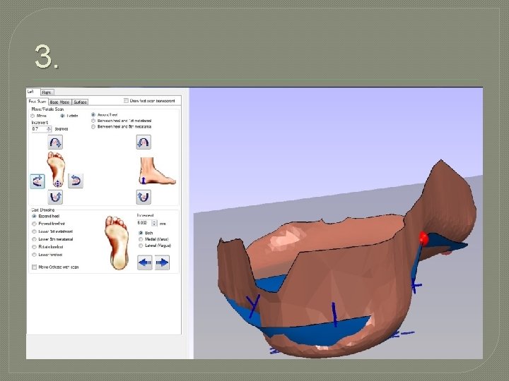 Customised Foot Orthoses Design We believe in the