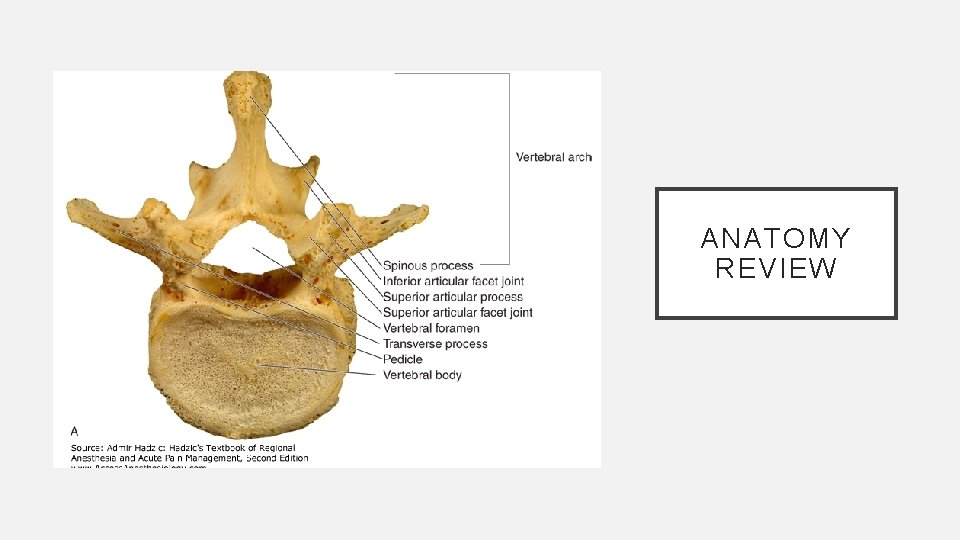 NEURAXIAL ANESTHESIA aka Epidurals and Spinals a very