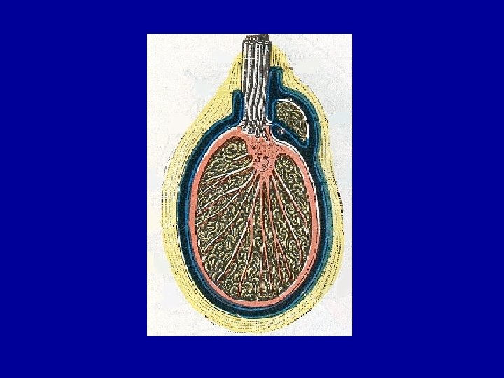 PATOLOGIA GENITAL EPIDIDIMITIS AGUDA El ms comn de