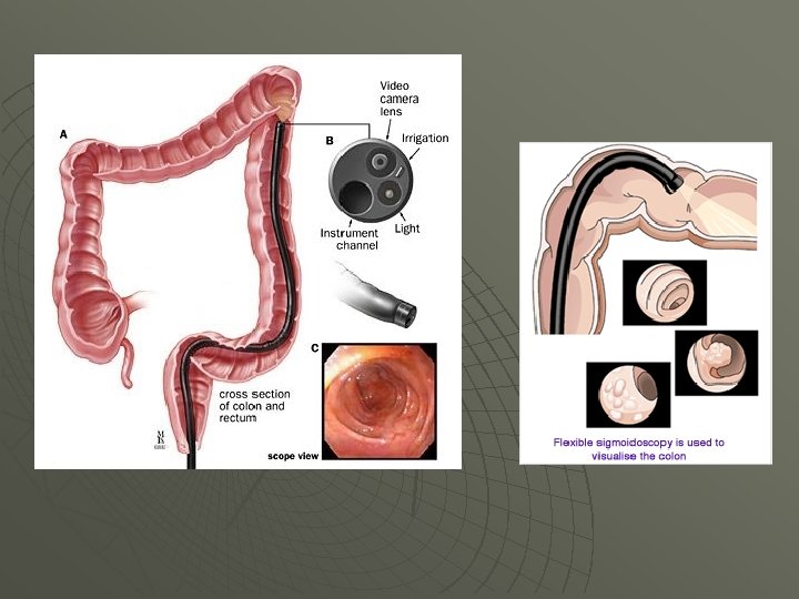 CONSTIPATION u Dfinition u Physiopathologie u Examen clinique