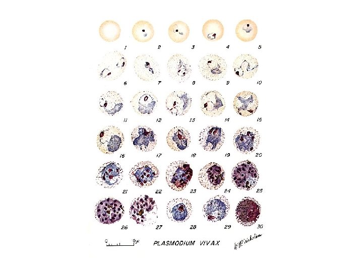 Plasmodium spp Filo Apicomplexa Ordem Eucoccidiida Famlia Plasmodiidae