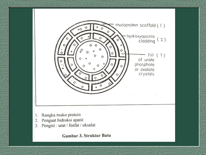 PEMBENTUKAN BATU SALURAN KEMIH Prof Dr dr RIFKI