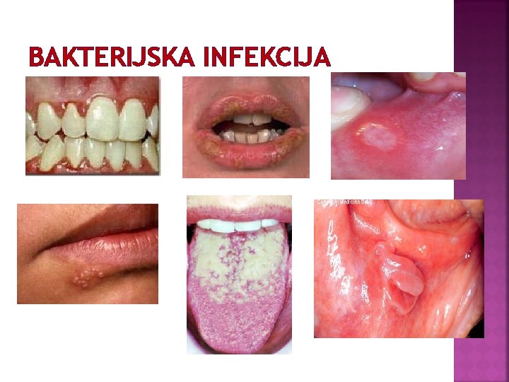 Dr sci Miljan Puleti Alergijske bolesti Imunodeficijencija Primarne