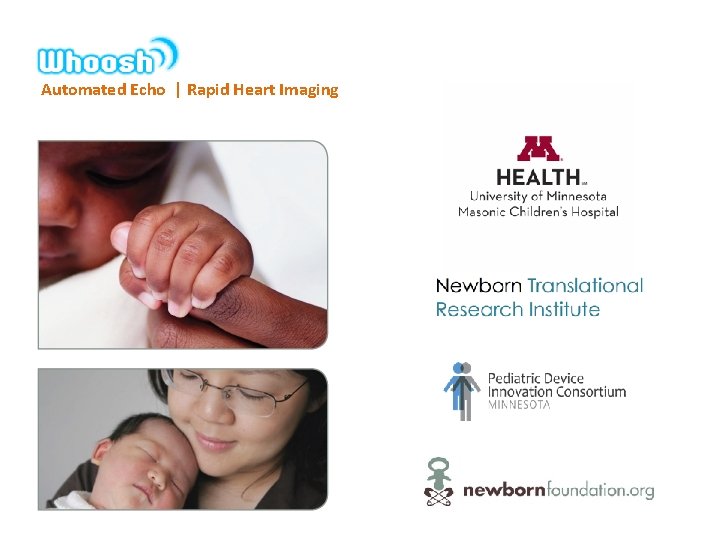 Automated Echo Rapid Heart Imaging What is the