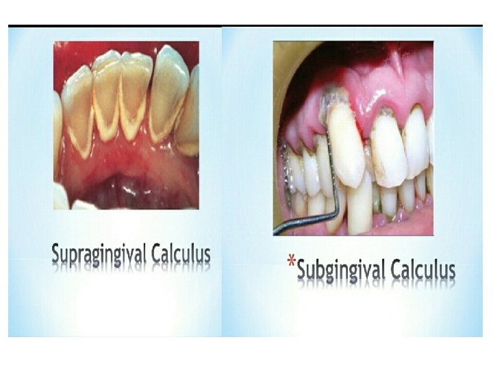 Lecturer Reham M M ALMosawi Medical Microbiology Bacteriology