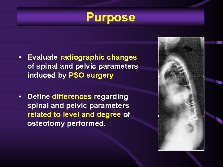 Does vertebral level of Pedicle Subtraction Osteotomy correlate