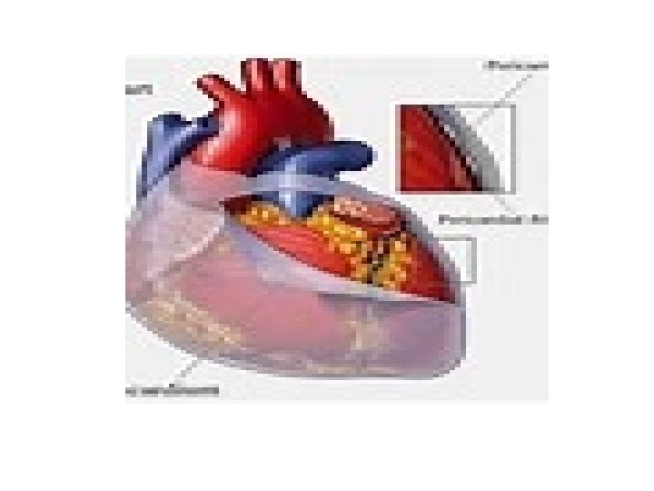 Lecture on pericardium and pericardial fluid By Dr