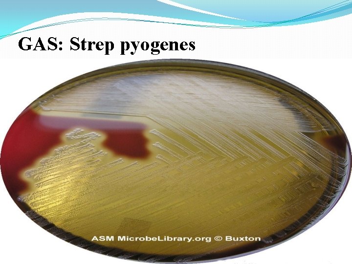 STREPTOCOCCI Dr QuratUlAin Senior Demonstrator Microbiology KEMU Lahore