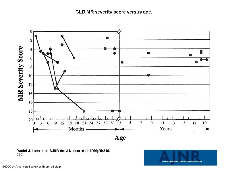 Globoid Cell Leukodystrophy Distinguishing EarlyOnset from LateOnset ...