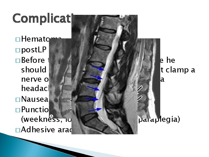 Lumbar Puncture Student Stanciu Elena What is it