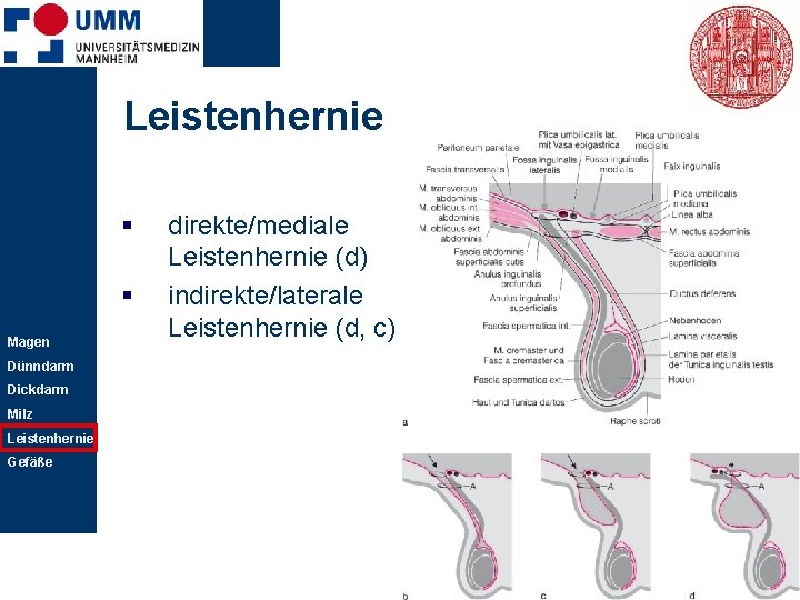 Anatomie von Magen Dnn und Dickdarm Milz Leistenhernie