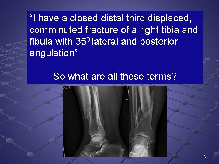 The Language of Fractures How to describe that