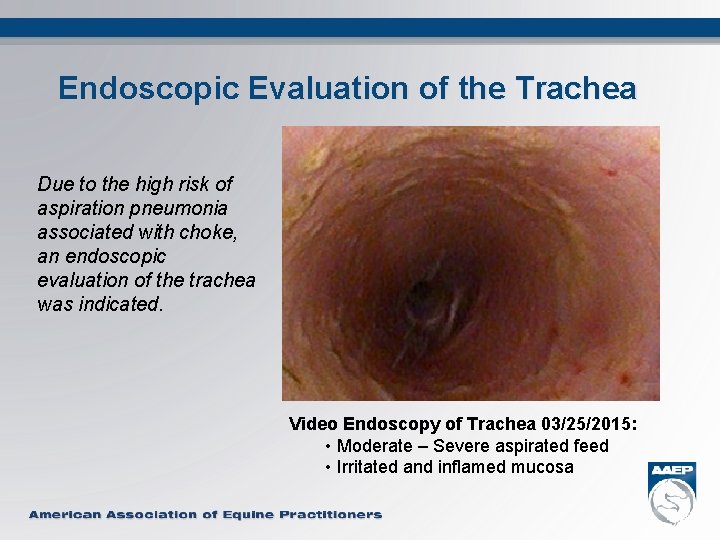 Treatment of an Esophageal Rupture Laura K Marley